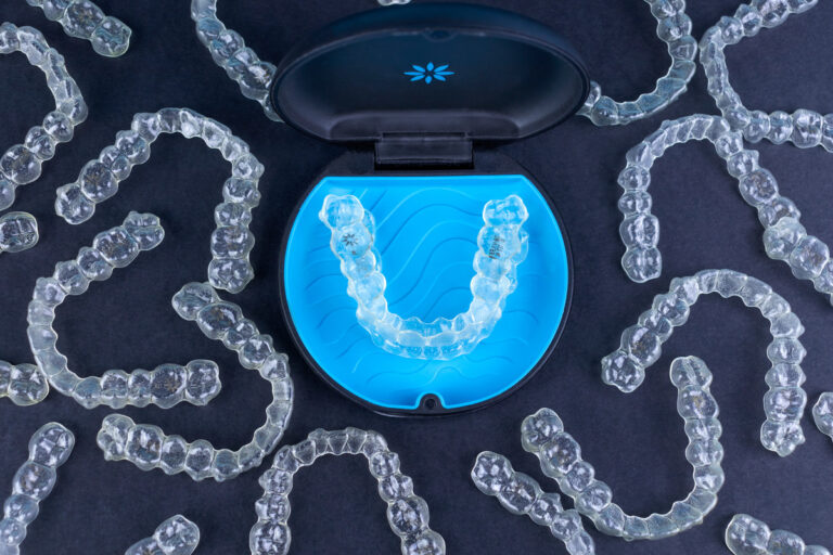 Invisalign Not Tracking - How To Tell ? (2024 Tips)